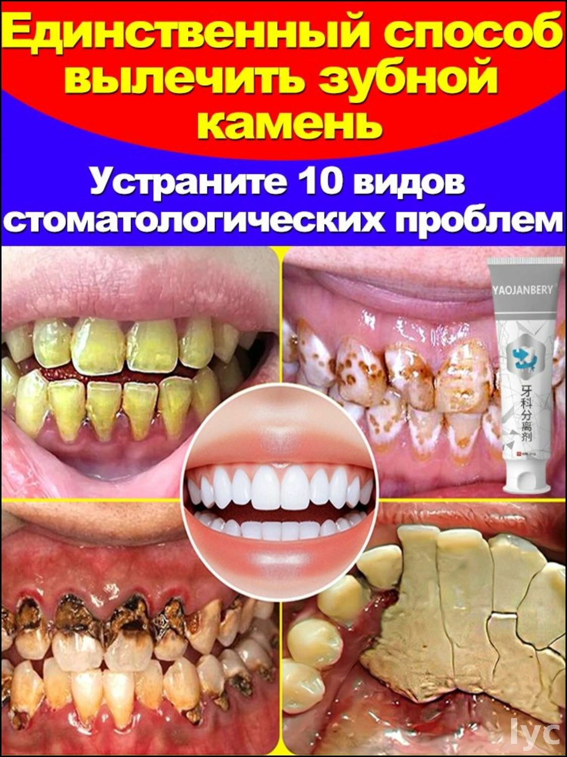 Эксклюзивная паста для удаления камня, налета и пятен с отбеливающим эффектом