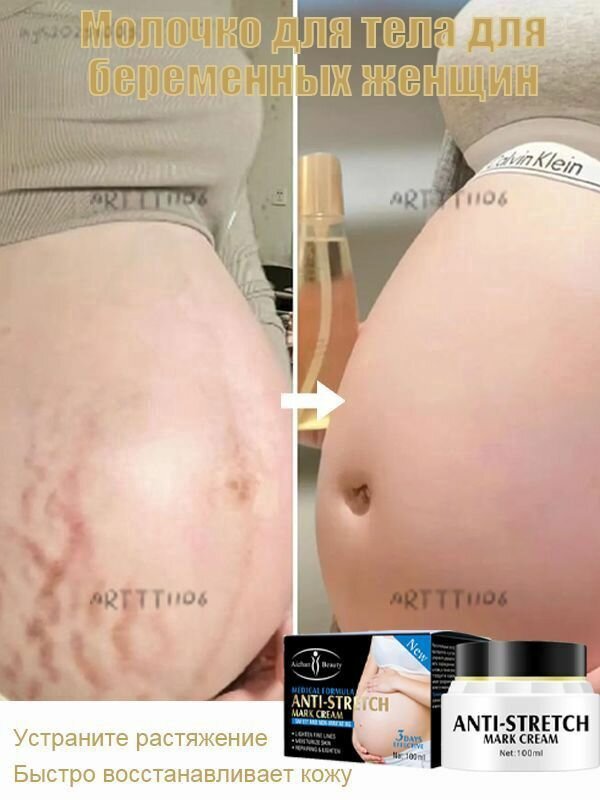 Крем от растяжек для беременных, растяжек во время беременности после родов, восстанавливает и поддерживает эластичность кожи, подходит для ног и живота, питает кожу vIJL202511221093fOJdF