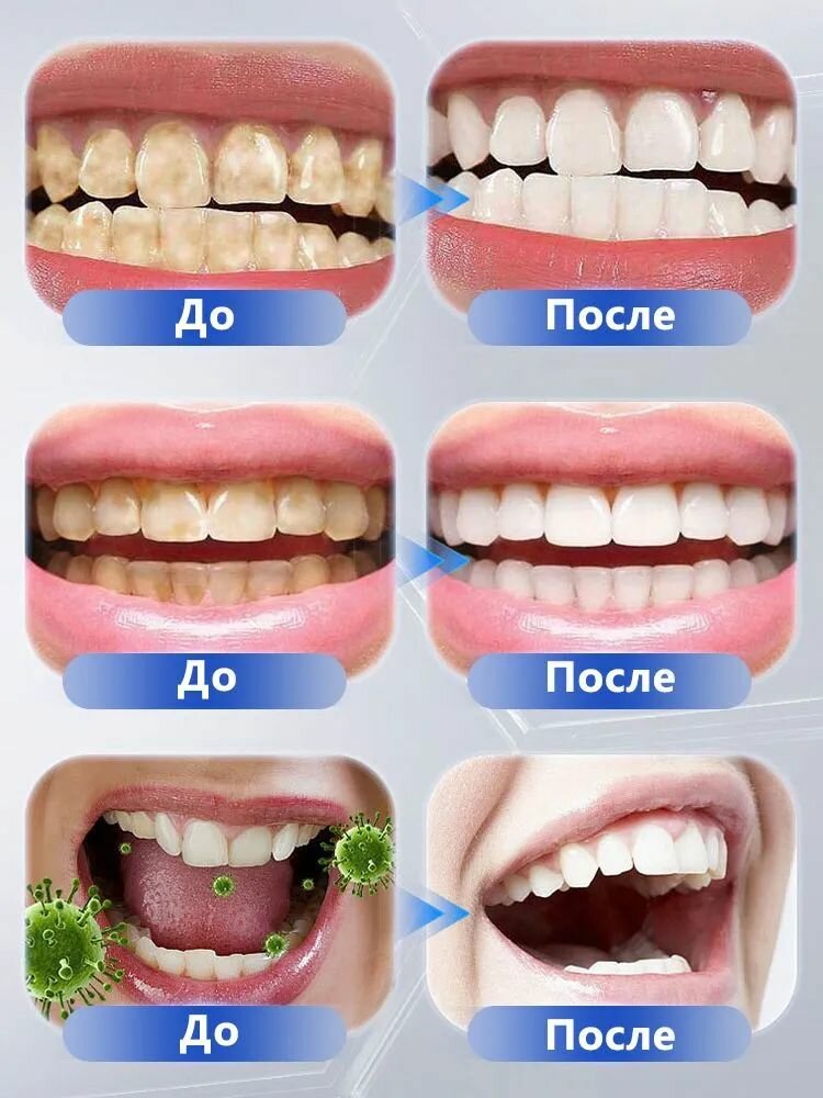 Отбеливающая зубная паста с лизоцимом, удаление налёта и зубного камня, свежесть дыхания и уход за деснами — фото 1