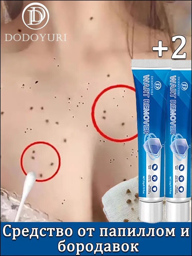 Крем средство для удаления бородавок, папиллом и родинок, безболезненно, не оставляет следов / 40г