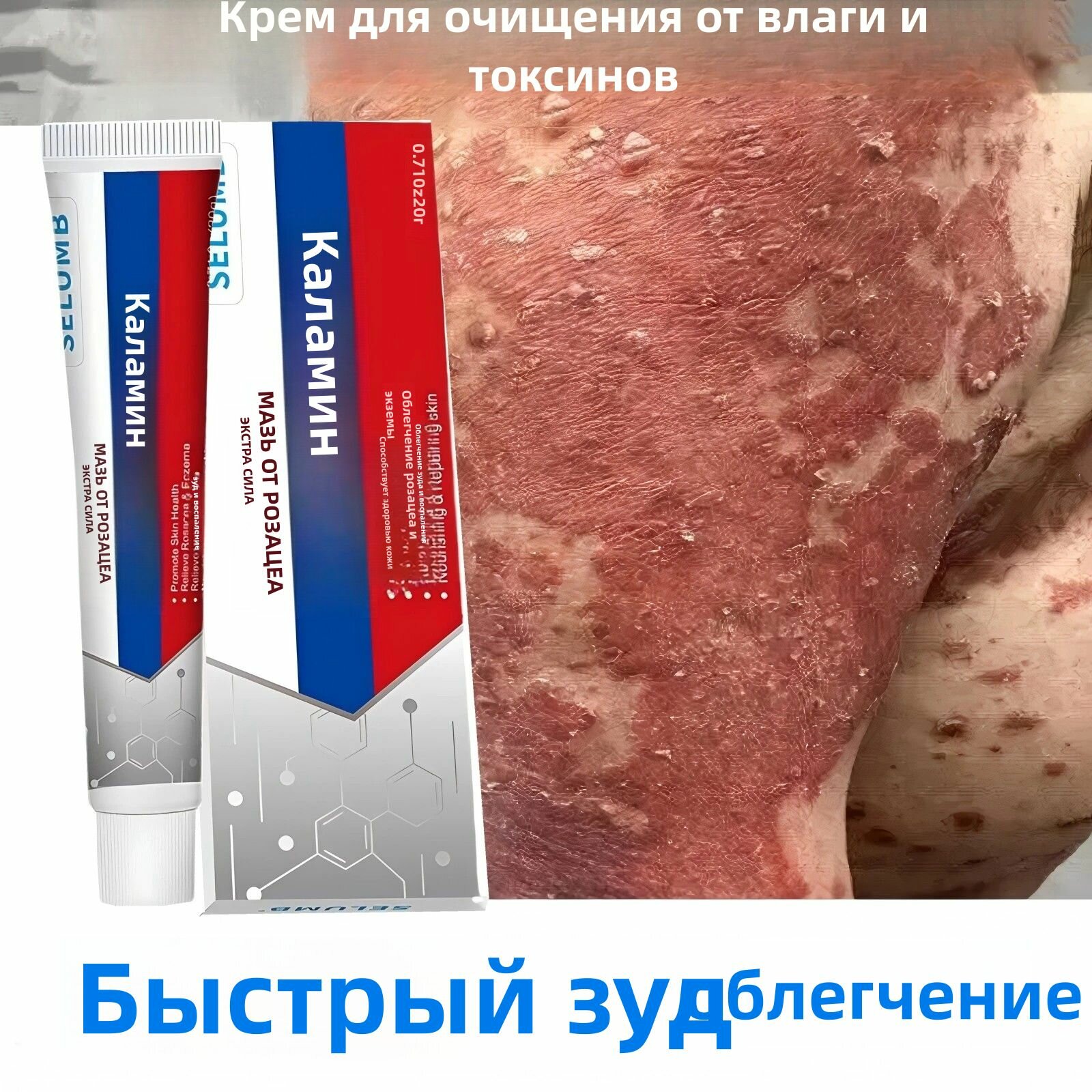 Крем с каламином от зуда. Успокаивает за 3 сек. Экзема, укусы. Гипоаллергенный, подходит для младенцев и чувствительной кожи. Лидер продаж в Европе.