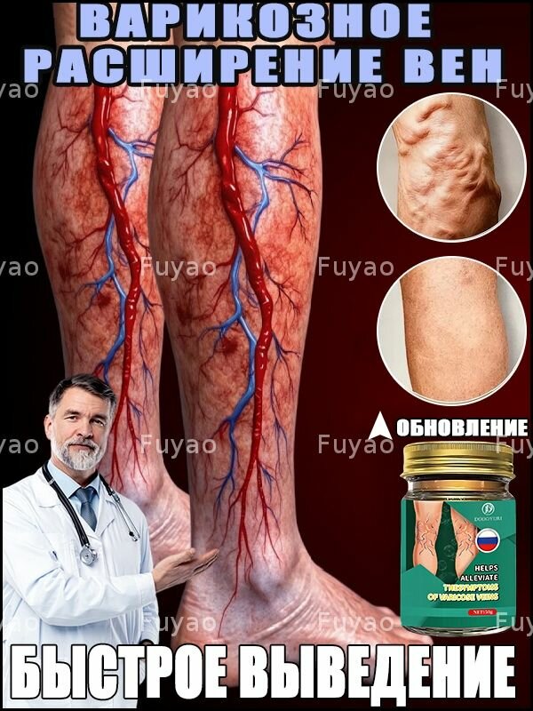 От варикоза ног, для сосудов, отеков и тяжести в ногах, сосудистых звездочек, Эффективен при лечении варикозного расширения вен, 50 мл