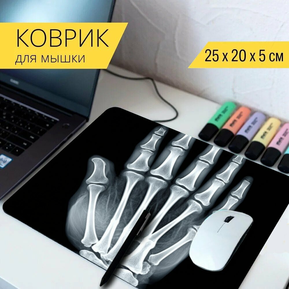 Коврик для мыши с принтом "Рентгеновский снимок человеческой кисти, на котором четко видны кости, суставы и мягкие ткани. изображение выполнено в черно-белом цвете, с." 25x20см.
