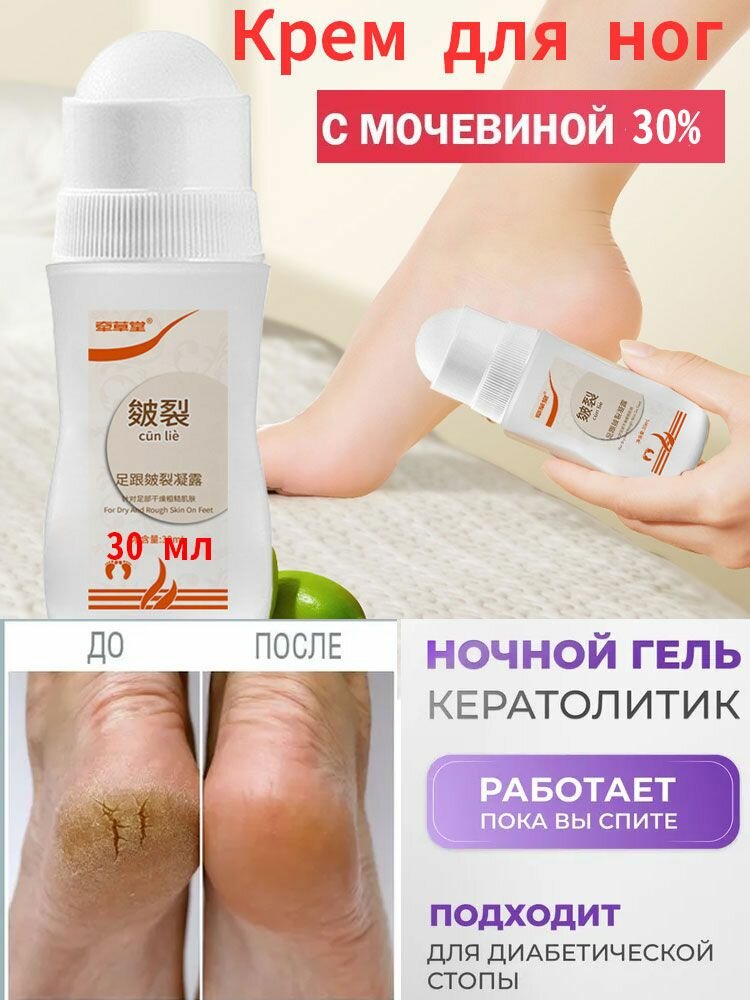 Ночная маска-кератолитик для стоп с мочевиной 40 % "Чудо пятки", 30 мл