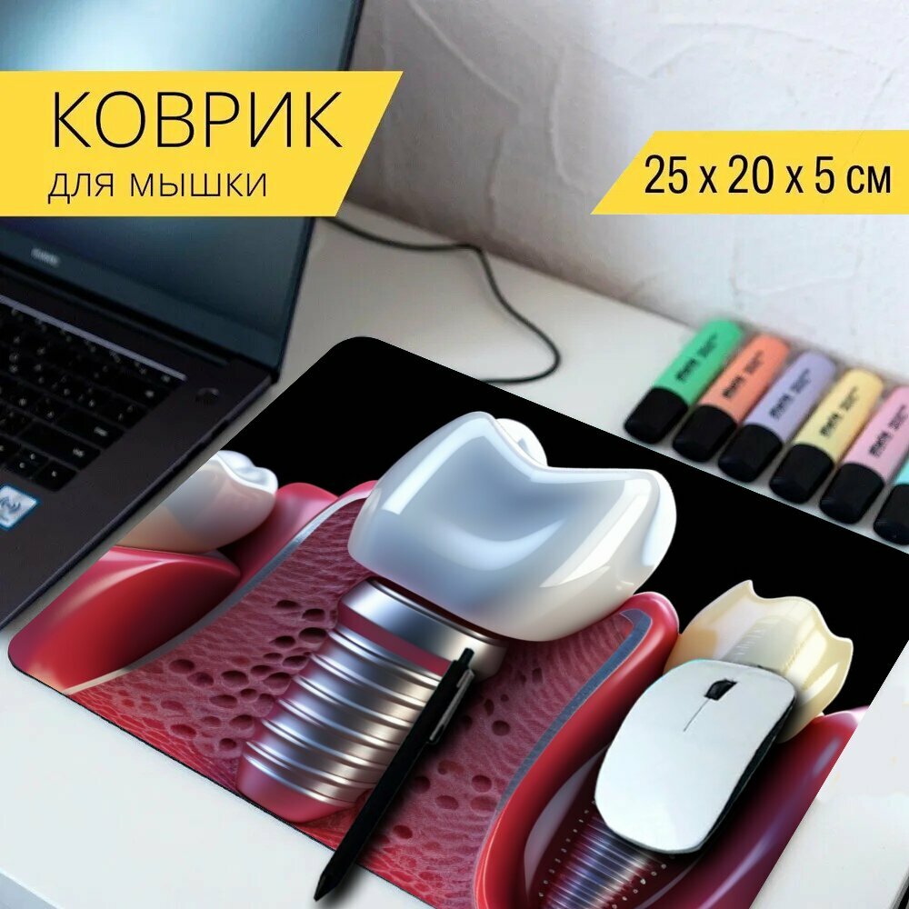 Коврик для мыши с принтом "Трёхмерная модель зубного импланта на экране" 25x20см.
