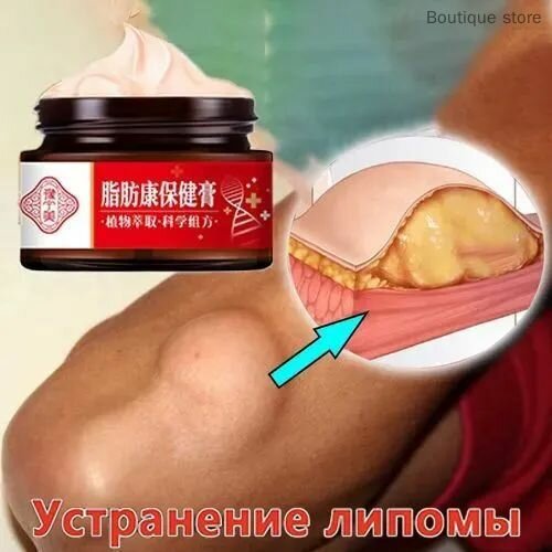 Мазь от липом и жировиков, быстро удаляет подкожные жировые опухоли, натуральный китайский, травяной крем для удаления целлюлита устранения, 30 г
