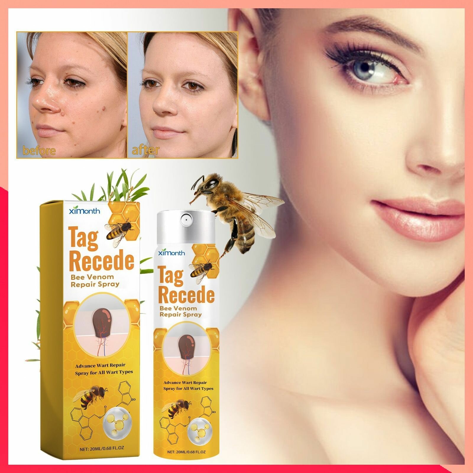 60ML Tag Recede Bee Venom, Средство от папиллом и бородавок, мазь для ухода за кожей 60 мл