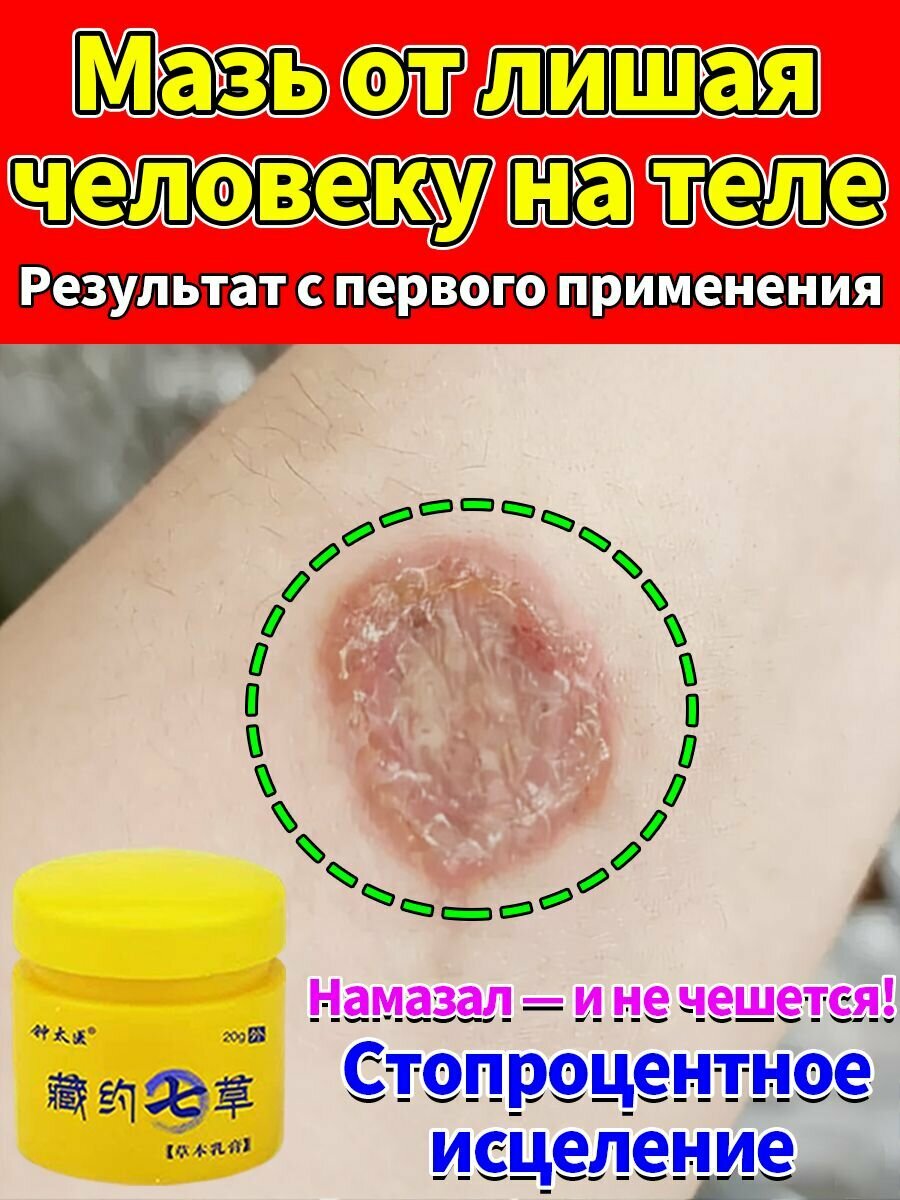 Мазь от лишая на теле у человека
