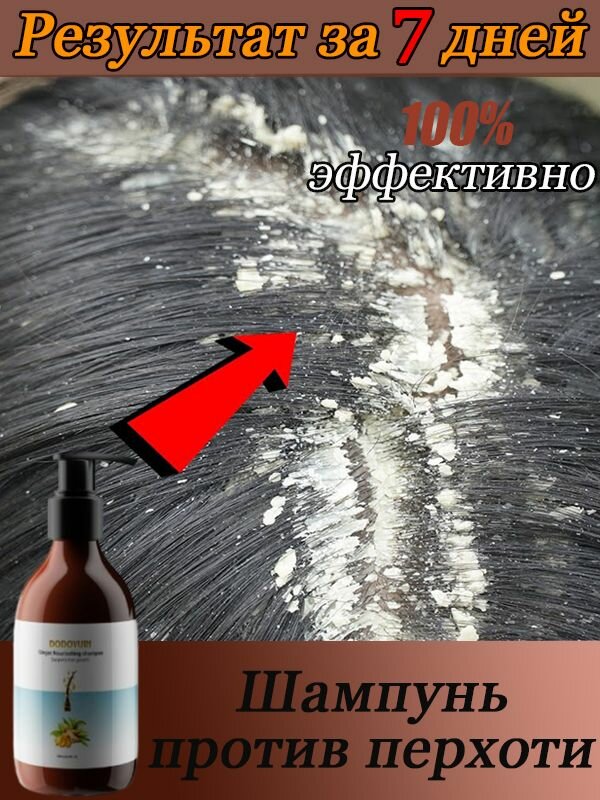 DODOYURI Лечебный шампунь против перхоти эффективно борется с перхотью, зудом кожи головы и себорейным дерматитом. Подходит для всех типов волос. 300 мл.