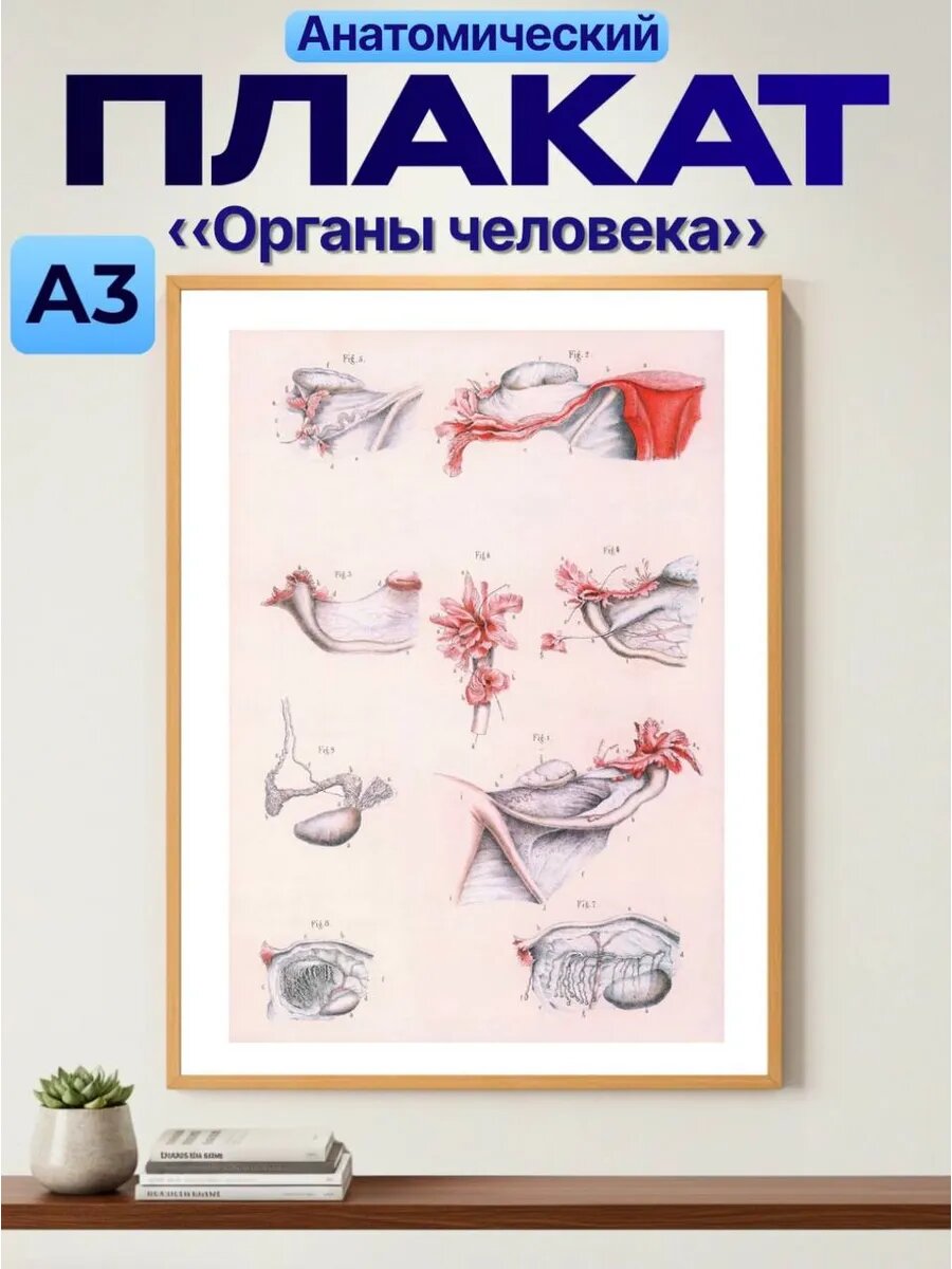 Постер медицинский, яичники, органы человека, А3 анатомия, хирургия