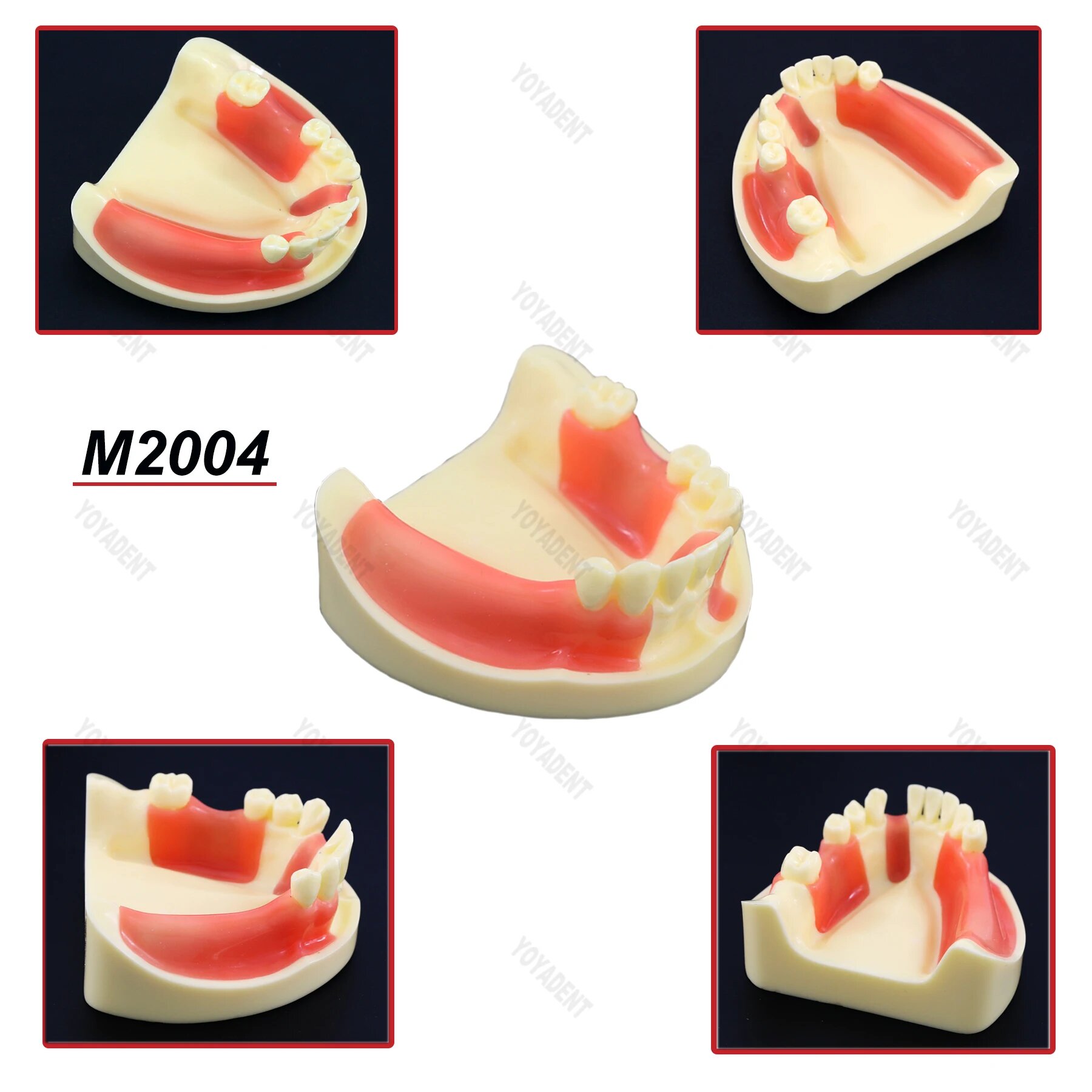 Съемные модели зубов YOYADENT из смолы M2004