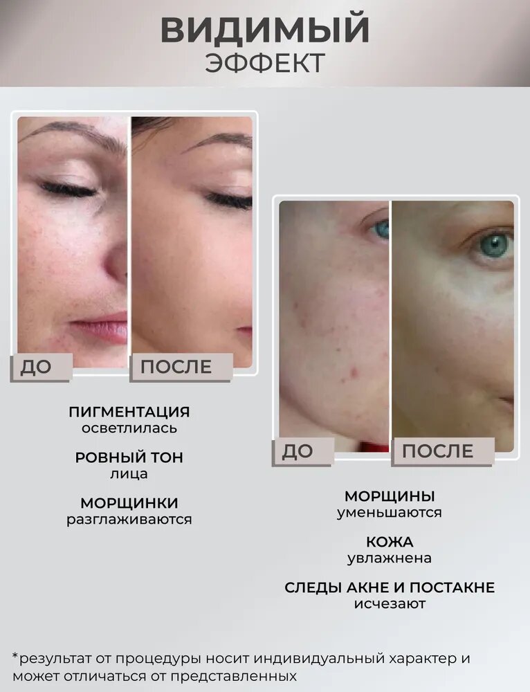 Косметологический комбайн Dr. Pen Ultima M8S-W для мезотерапии и ухода за кожей лица — фото 1