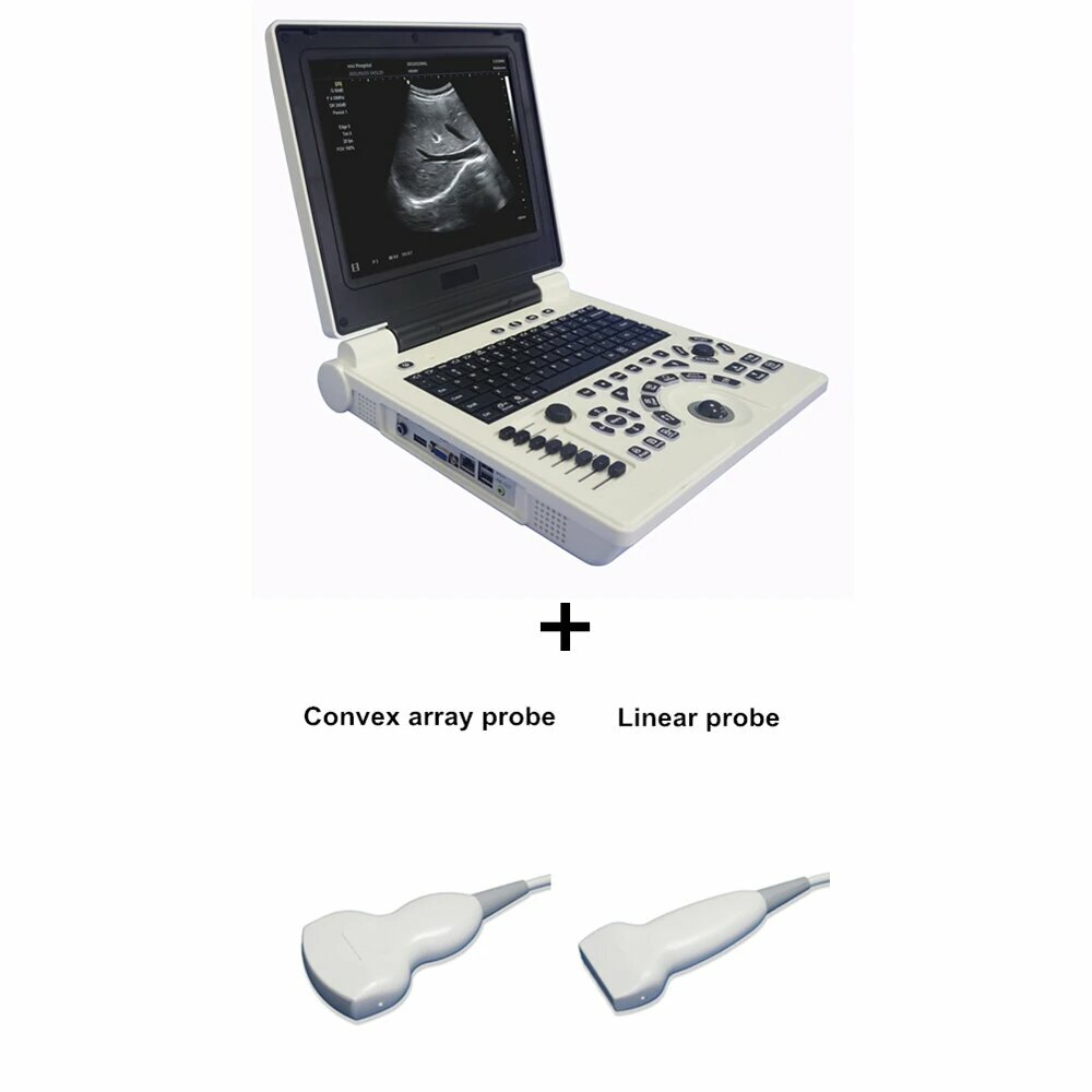 NESWELLMED Портативный ультразвуковой сканер USG Европейская вилка (EU Plug), convex-linear
