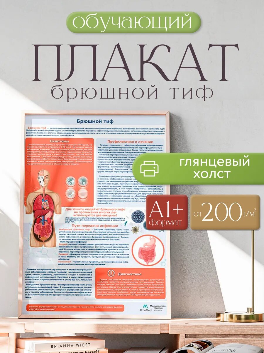 Брюшной тиф медицинский плакат глянцевый холст от 200 г/кв. м, размер A1+