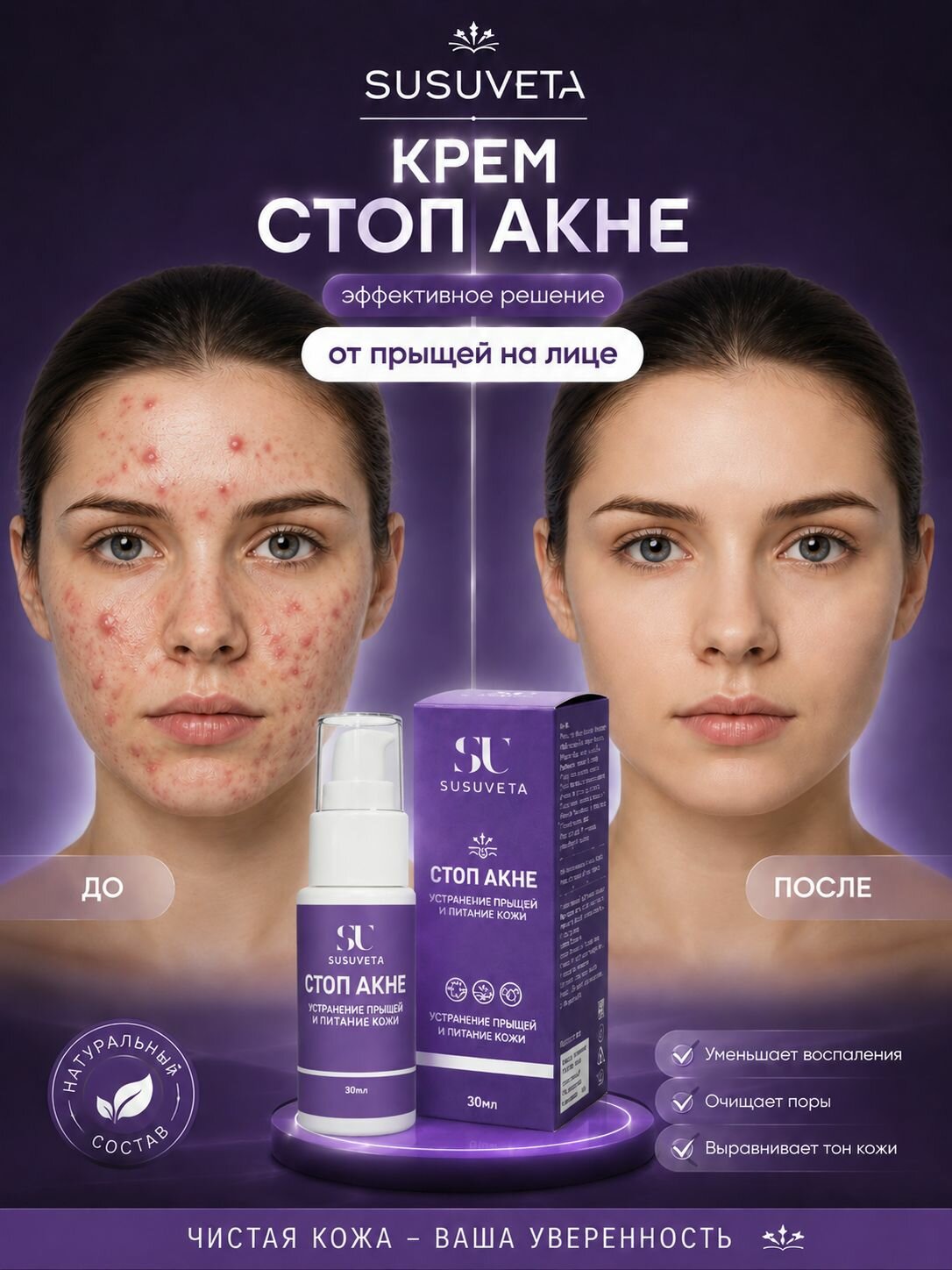 SUSUVETA крем от прыщей с азелаиновой кислотой, для жирной и сухой проблемной кожи лица, постакне, 50 мл