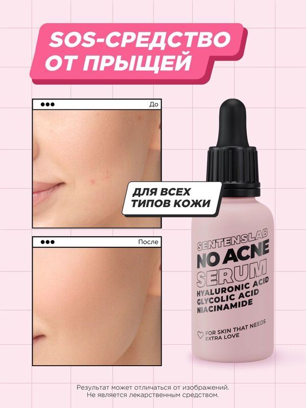 Сыворотка для лица точечная с ниацинамидом и гликолевой кислотой 30 мл, SENTENSLAB