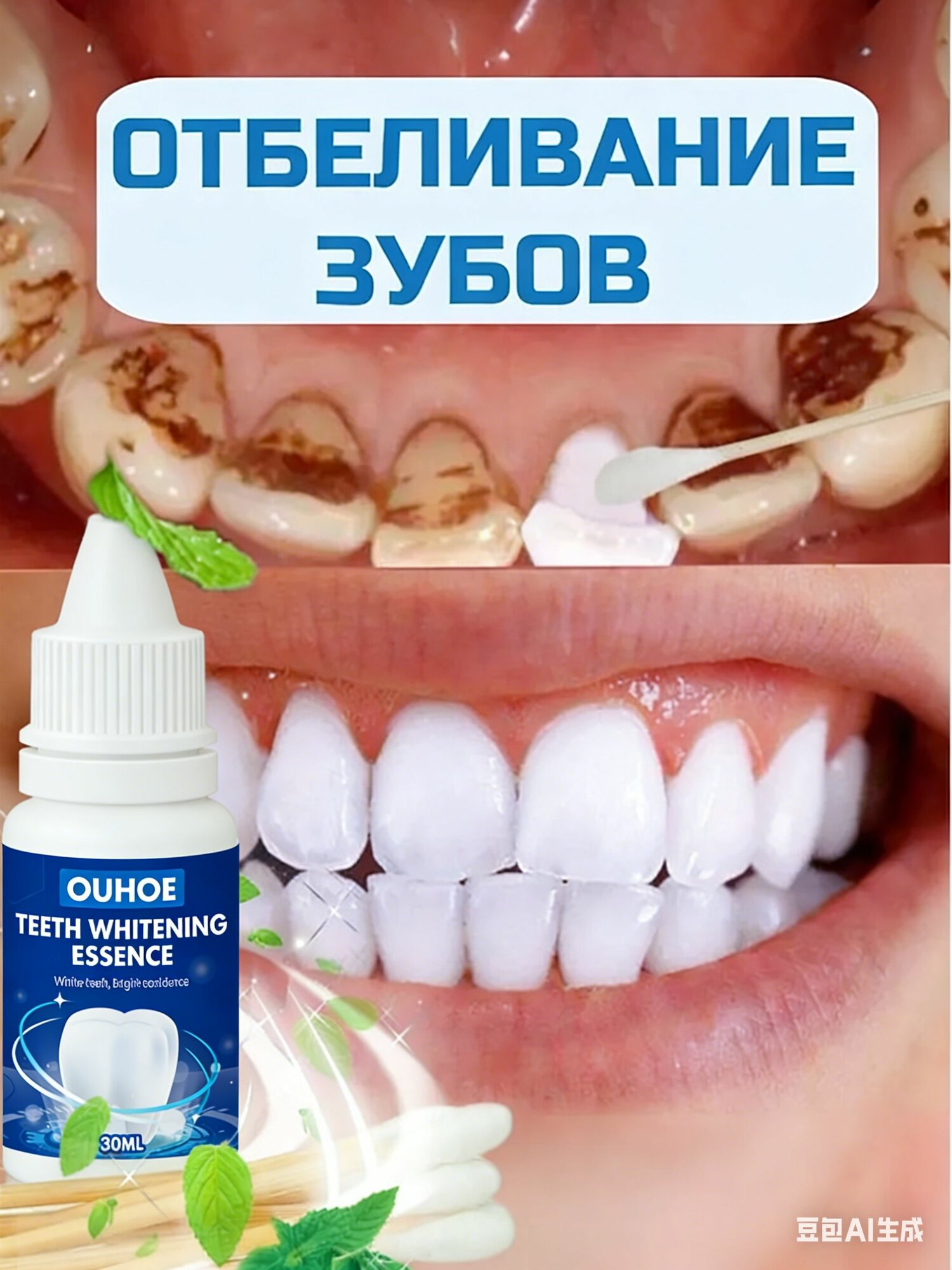 Отбеливание зубов, гель для домашнего отбеливания зубов, 30мл