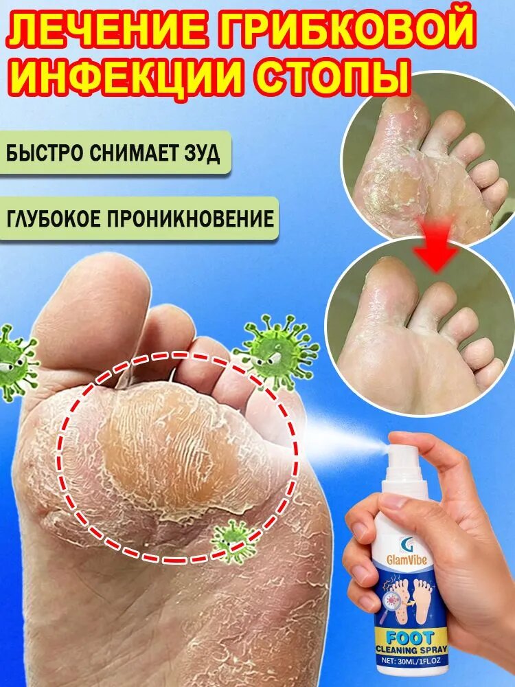 Противогрибковый спрей, применяемый при потрескавшихся пятках и стопах, псориазе, зуде, микозах, снимает грибок ногтей, подавляет рост бактерий.30 мл