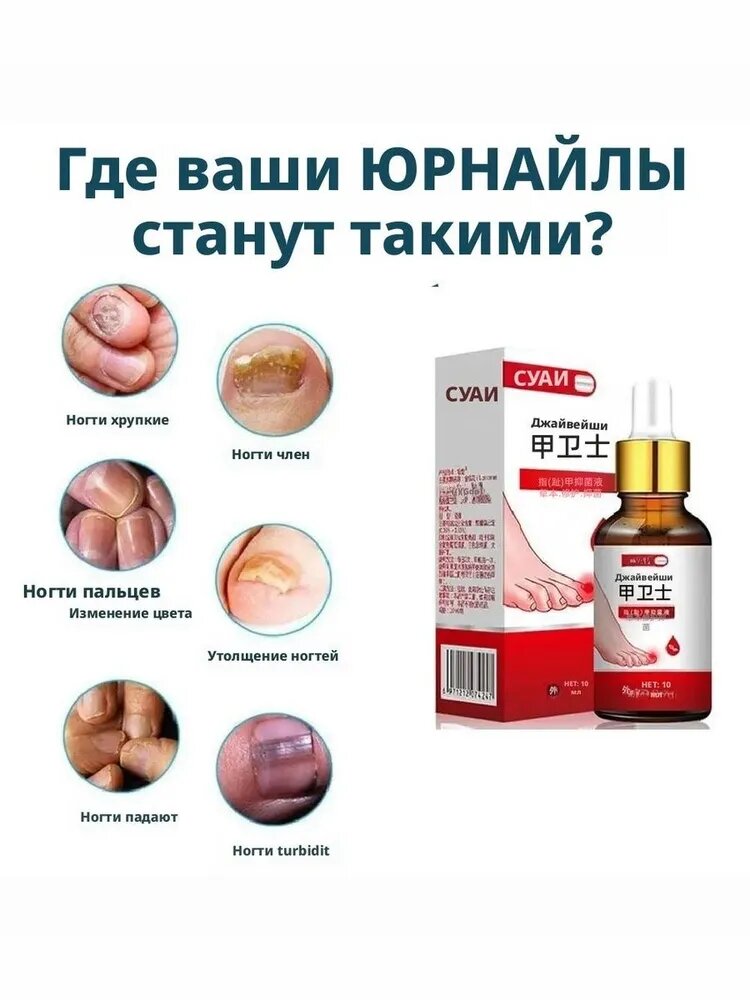 Сильная эссенция для лечения грибка ногтей, удаление грибка ногтей на ногах, 10 мл