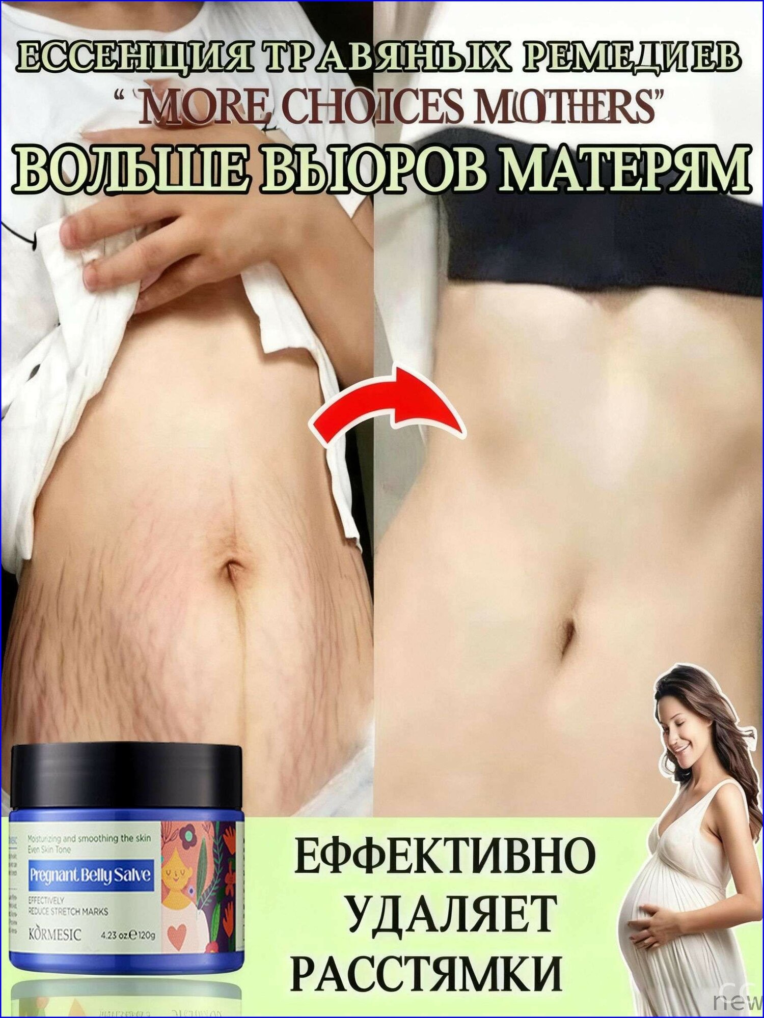 Средство от растяжек