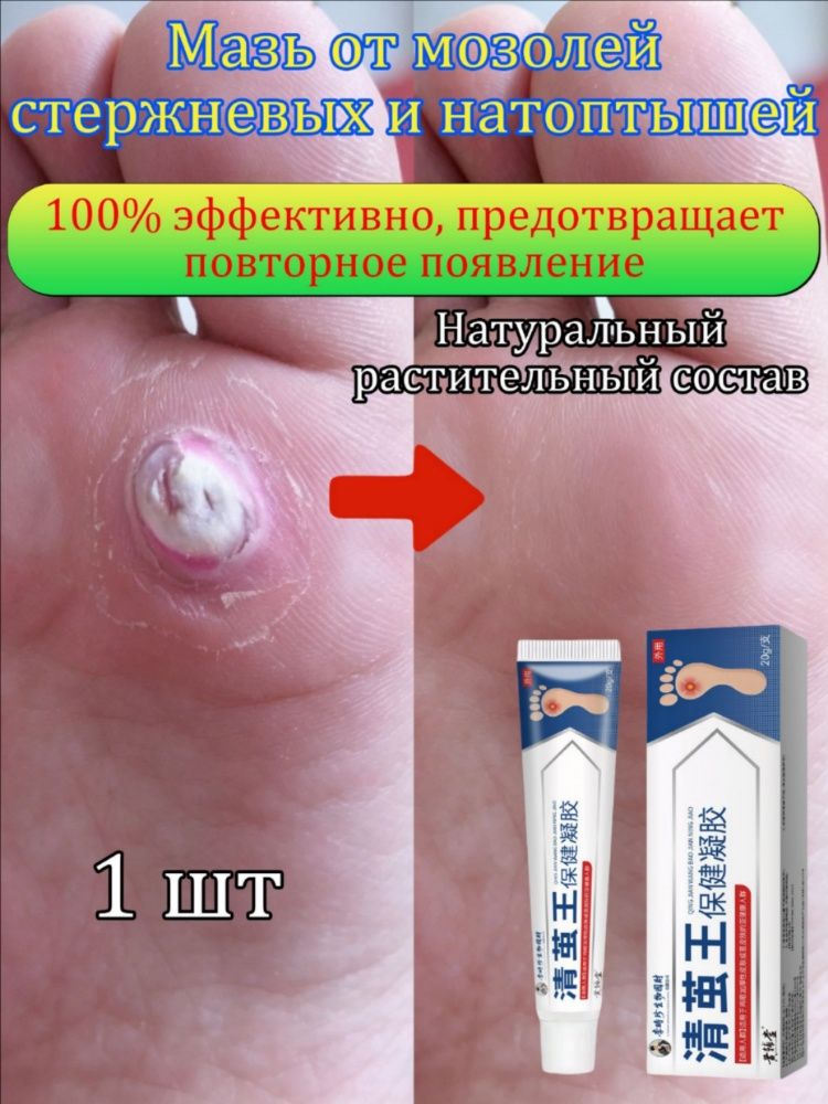 Mазь от мозолей стержневых и натоптышей , Крем от сухих мозолей, шипицы, бородавок, натоптышей,20 г 1 шт.