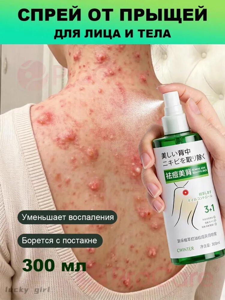 Спрей тоник для лица с азелаиновая кислота от прыщей и акне, угрей и черных точек, подходит для подростков с ч