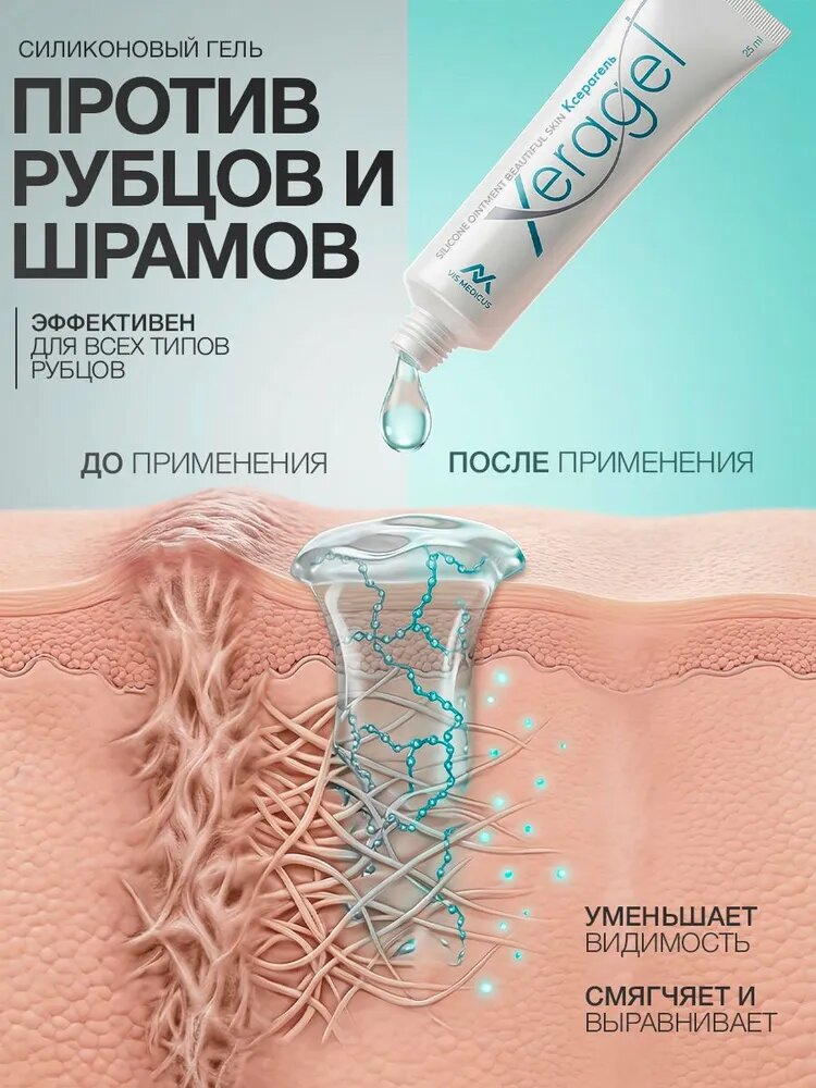 Гель от шрамов и рубцов Xeragel / Крем от растяжек, от ожогов, на силиконовой основе / 25 ml