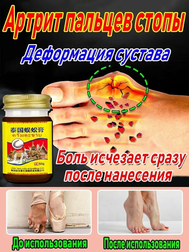 Обезболиващя мазь при артре и ревмтоином аррите стпы, 55 г