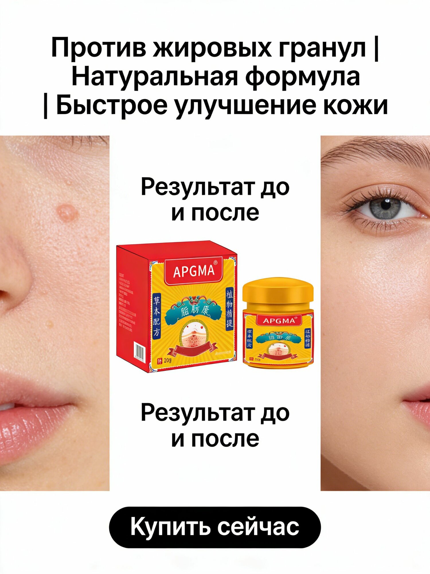 Мазь от жировиков на коже, 20 г