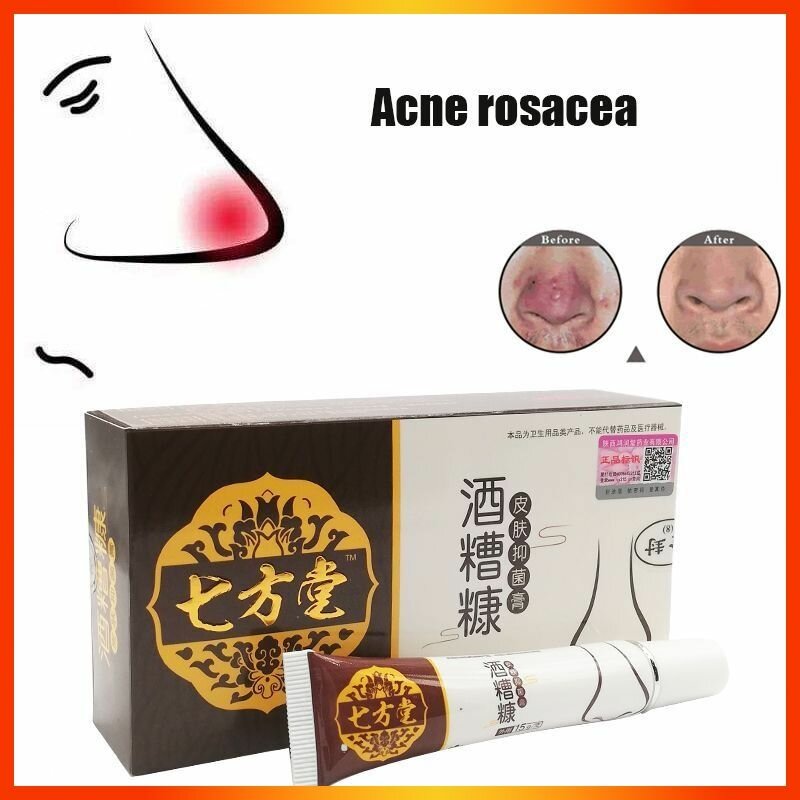 Мазь от розацеа, уход за лицом, 15 г.