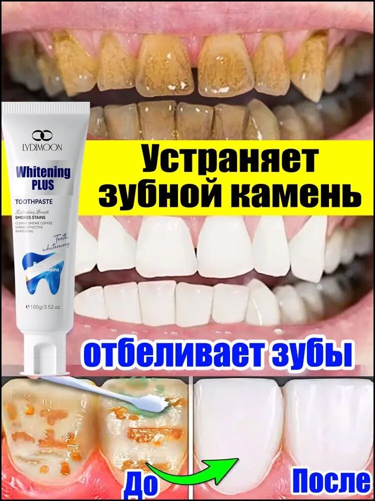Паста зубная бестселлер