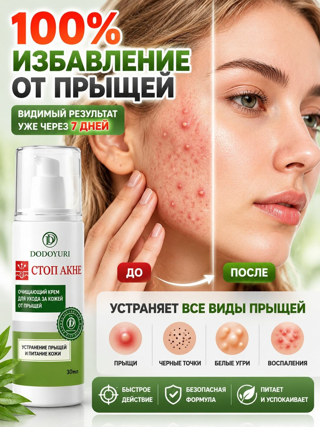 DODOYURI Крем от прыщей, подходит для подростков и проблемной кожи, эффективно борется с прыщами, угрями, акне и черными точками, 30 г