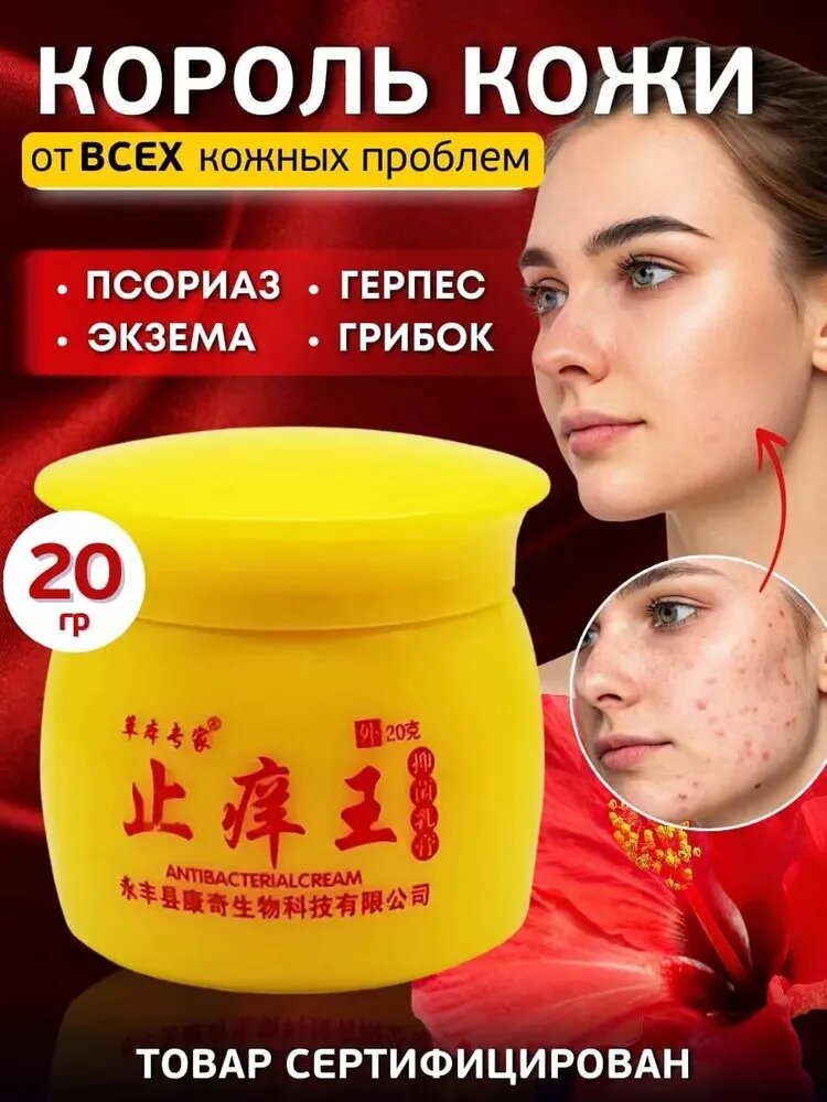 Крем Король кожи от всех проблем с кожей (псориаз, экзема, герпес, грибок)