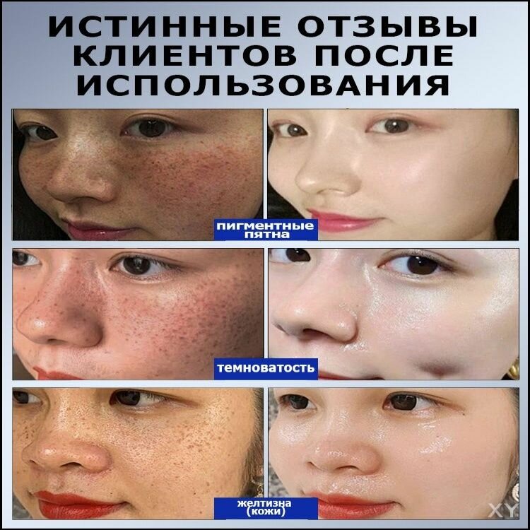Крем для ухода за кожей — фото 1
