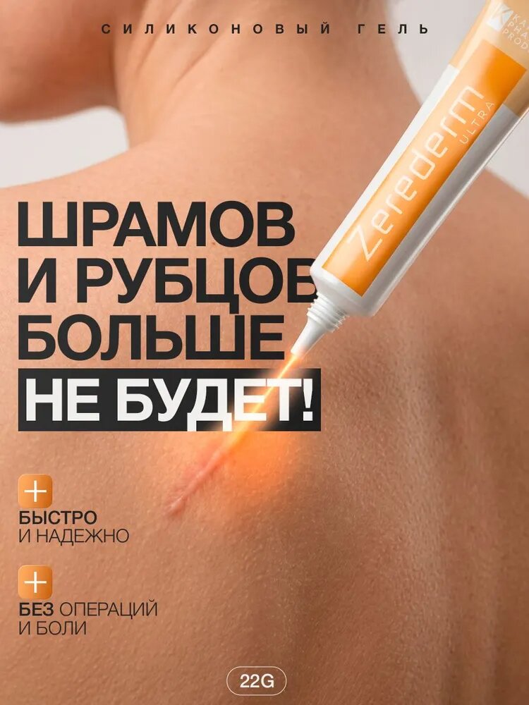 Гель от шрамов Zerederm / Крем от шрамов и рубцов, от растяжек, от постакне, для осветления, восстановление, от ожогов, силиконовый гель / 30 мл
