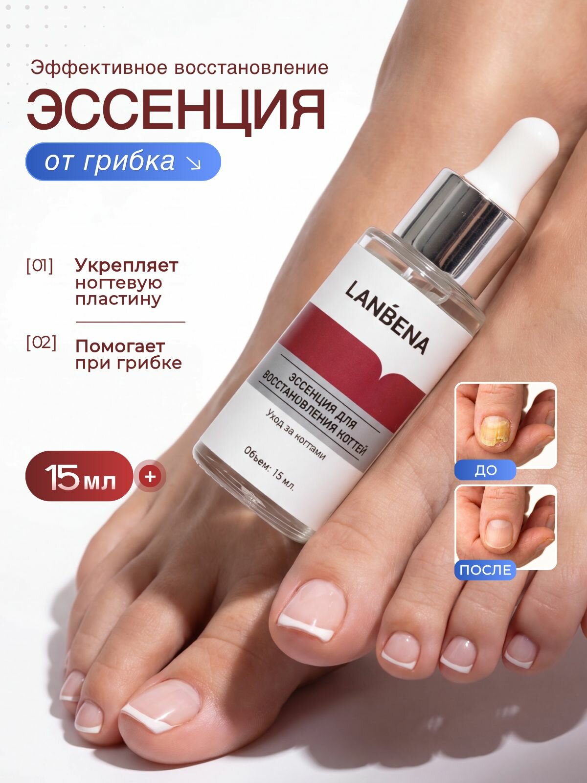LANBENA Средство от грибка ногтей на ногах / для эффективной борьбы с несовершенствами / Чудо средство для ухода за ногами против онихолизиса на русском против грибка для ногтей от онихолизиса