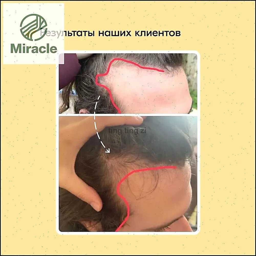 Лосьон для волос Zhangguang 101G Hair Tonic, 120 мл, для стимулирования роста волос — фото 1