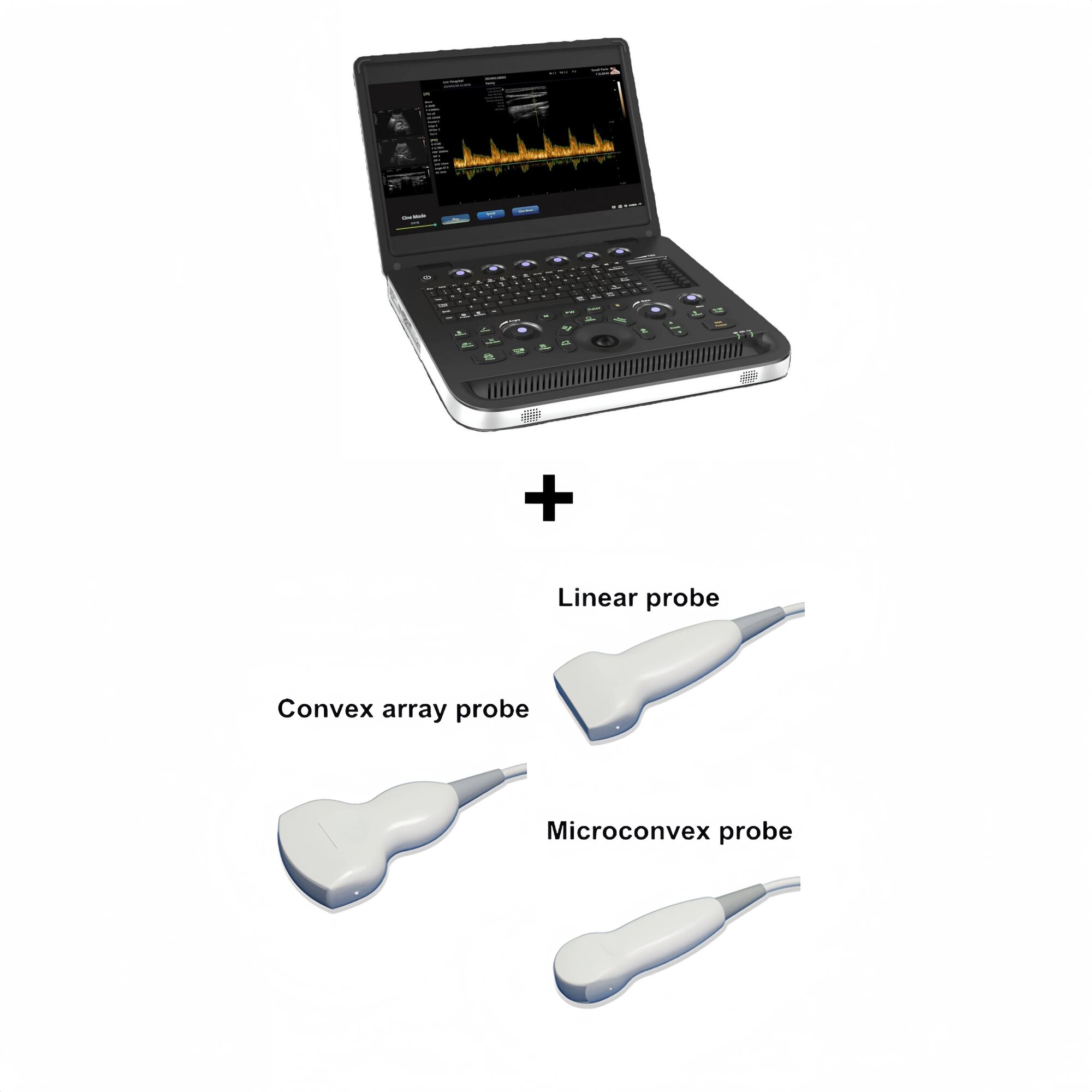 NESWELLMED 15-дюймовый ультразвуковой сканер Европейская вилка (EU Plug), convex-linear-micro