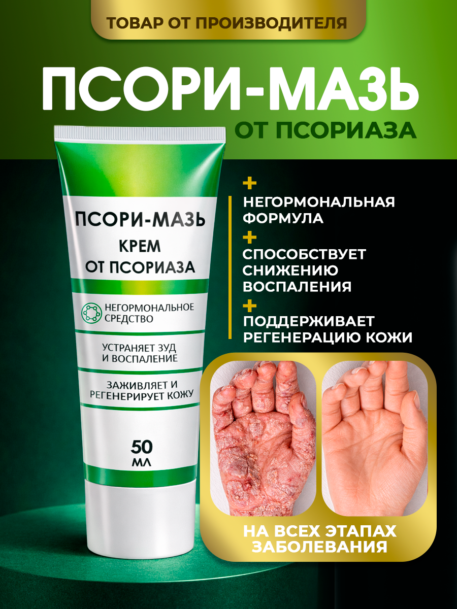 Комплекс от псориаза Псори-мазь, натуральный состав, туба, 50 мл