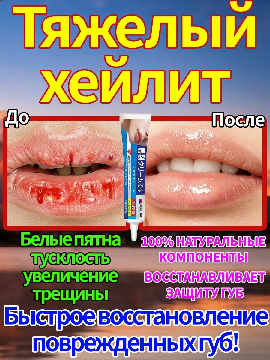 Крем для облегчения герпеса и хейлита, подходит для трещин и сухости губ.