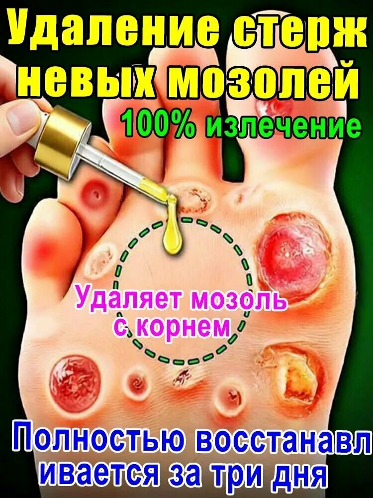 Китайская чудо-мазь от стержневых мозолей и натоптышей быстрое удаление без боли, 20 г