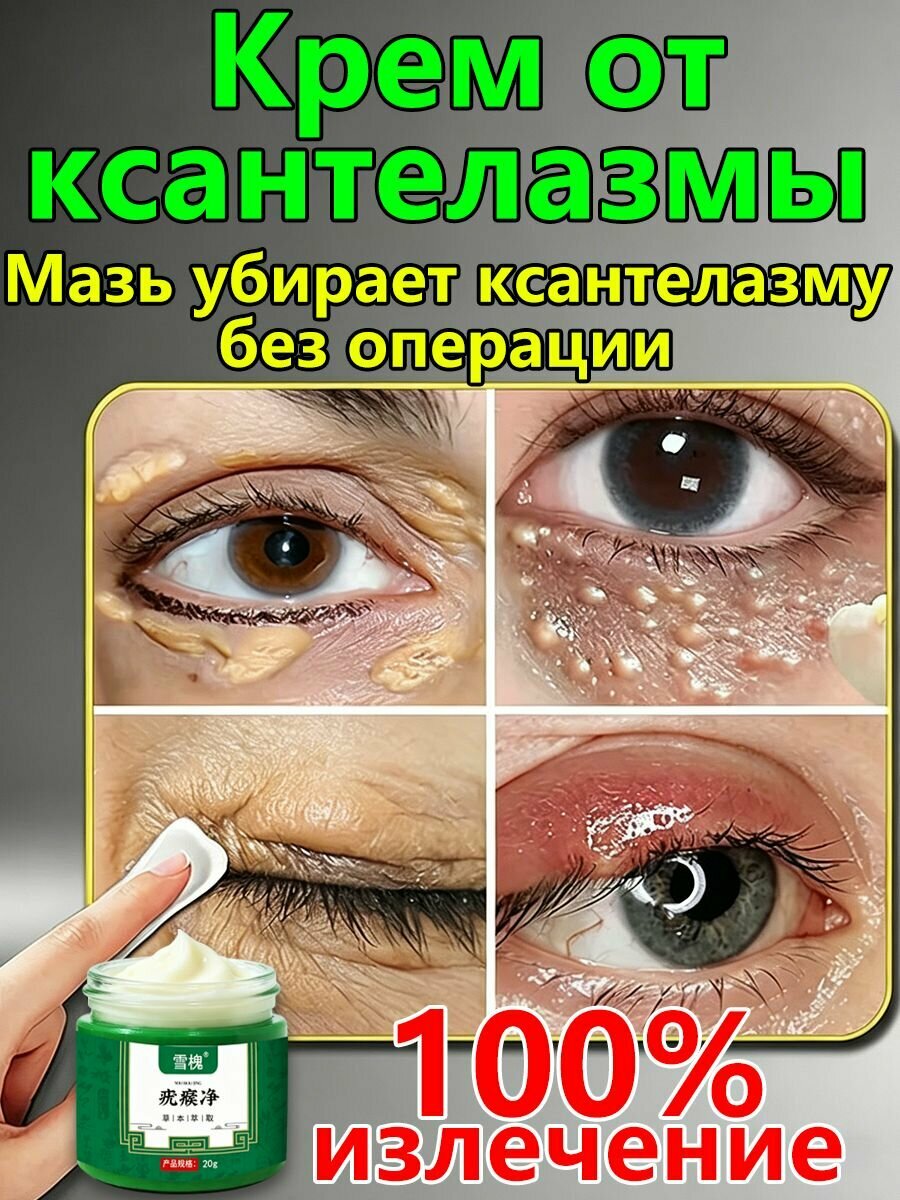 Мазь от ксантелазмы и ксантом на веках и лице. Лечение папул и желтых бляшек вокруг глаз. Эффективное средство против атеромы