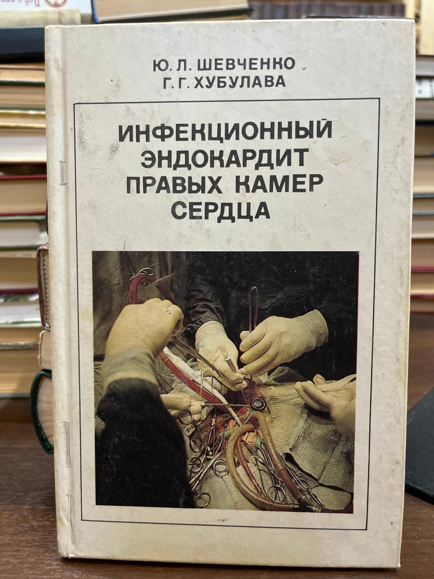 Инфекционный эндокардит правых камер сердца