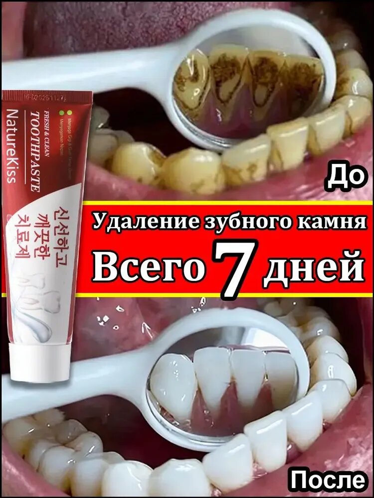 Корейская отбеливающая зубная паста/100 г/Удаляет пятна от курения, зубной камень и налет, подходит для чувствительных зубов, кровоточивых десен, кариеса/освежает дыхание