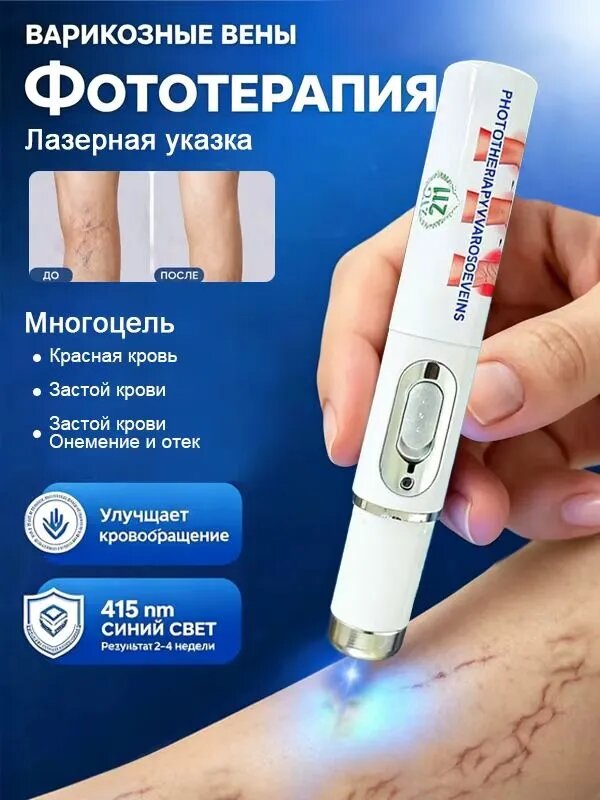 Лазерная ручка для лечения варикозного расширения вен. Эффективно устраняет варикозное расширение вен, сосудистые проблемы, сосудистые звездочки, тромбоз, отёки ног и тяжесть. Упаковка из 1 штук.