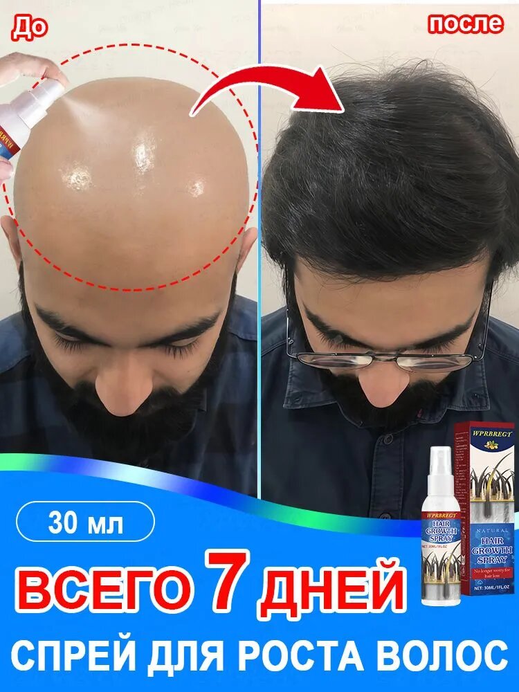 WPRBREGT Спрей для ухода за волосами, натуральный, для роста волос, 30 мл