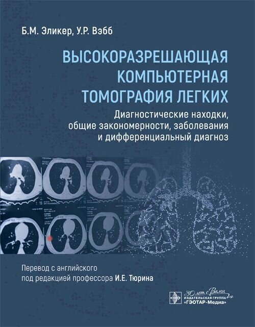 Высокоразрешающая компьютерная томография легких. Диагностические находки, общие закономерности, заб