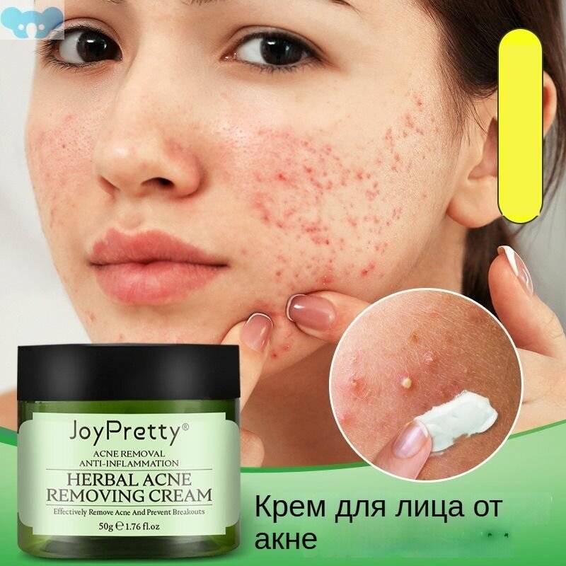 Крем от прыщей на лице и спине для подростков / Мазь для лица от акне и черных точек взрослому