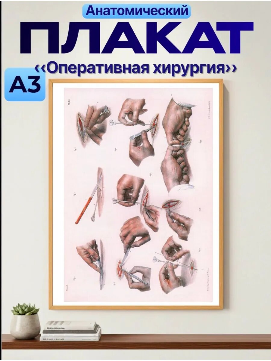 Постер медицинский, сосуды, оперативная хирургия, А3 анатомия, хирургия,