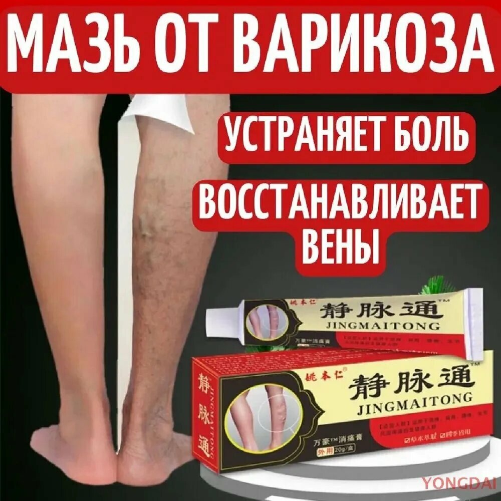 Китайская мазь от варикоза вен на ногах Джинг Май Тонг